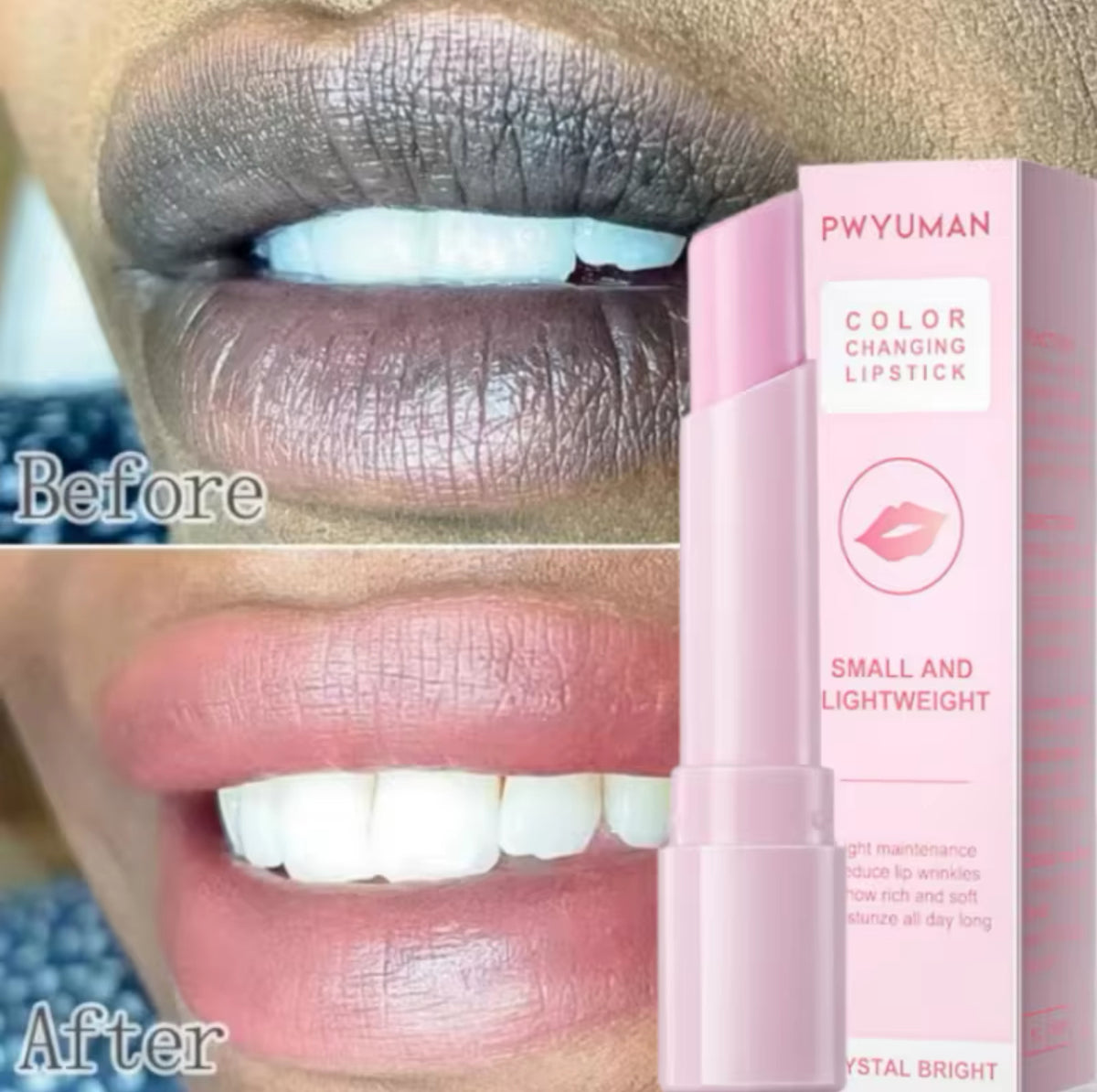Hyperpigmentation Lip Corrector – Beauty By Prima